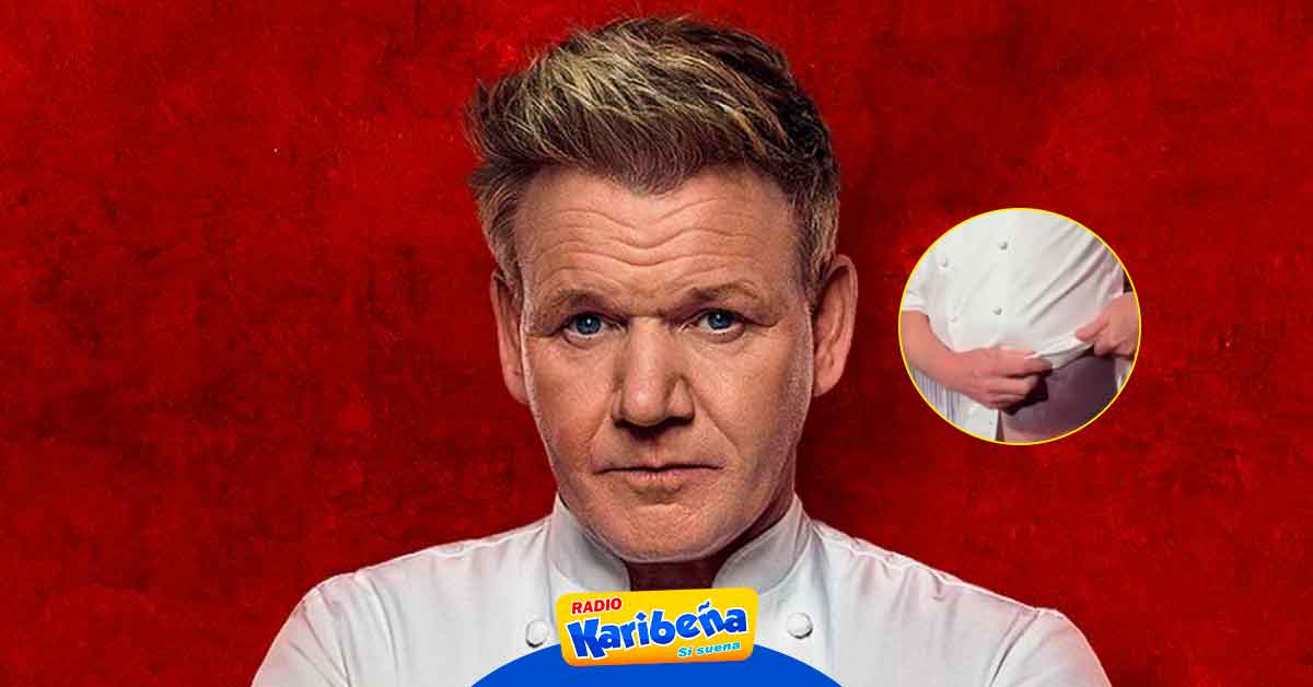 ¡Casi no la cuenta! Reconocido chef muestras sus heridas tras grave ...